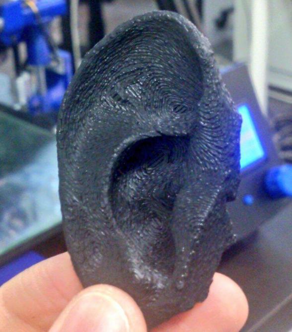 3D Printing Ears - Student Aims to Fix Congenital Deformity Via 3D ...