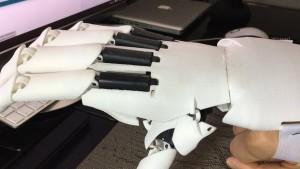 YouBionic: 3D Printed Bionic Prosthetic Now Available for Pre-Order ...