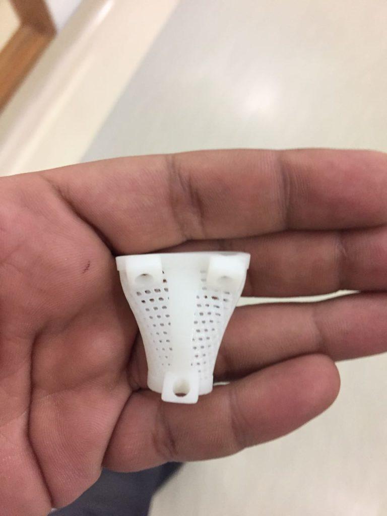 For the First Time in India, 3D Printed Titanium Vertebrae Restore a ...