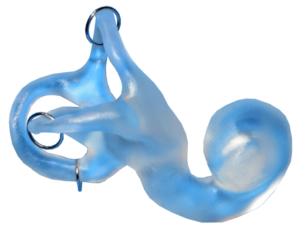 Understanding Vertigo by 3D Printing the Inner Ear - 3DPrint.com ...