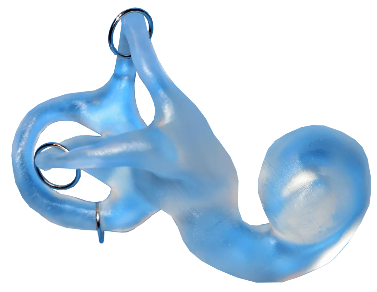 Understanding Vertigo by 3D Printing the Inner Ear - 3DPrint.com ...