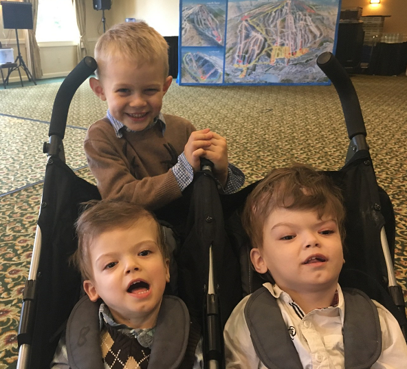 Formerly Conjoined McDonald Twins Progressing and Hitting Milestones ...