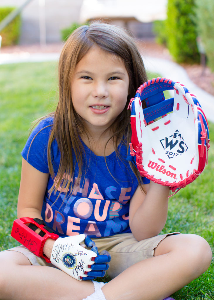 Seven-Year-Old with 3D Printed Prosthetic Hand to Throw Out First Pitch ...