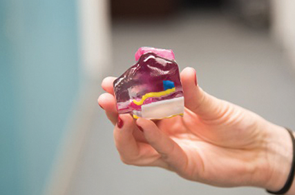 PhD Candidate 3D Printing Kidney and Prostate Models for Clinical Trial ...