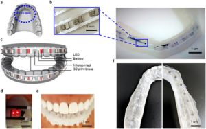 3D Printed Smart Braces with Flexible Batteries and LEDs Can Improve ...