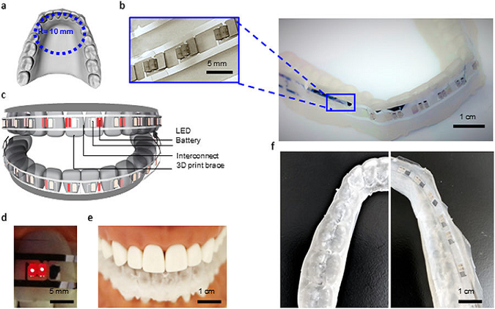 3D Printed Smart Braces with Flexible Batteries and LEDs Can Improve ...