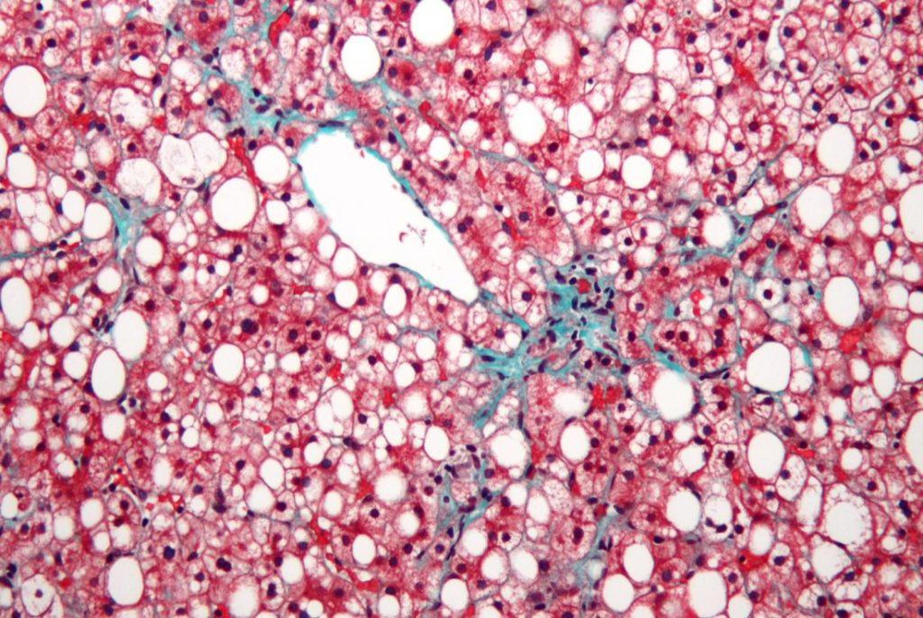 Organovo & Viscient Biosciences Collaborate for 3D Bioprinting in Liver ...