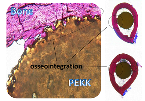 3D Printed PEKK Structures Shown to Offer Superior Antibacterial ...