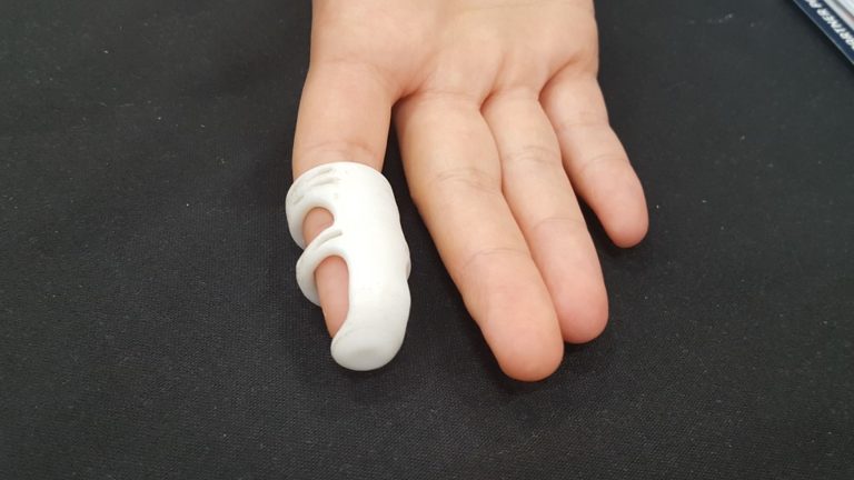 EXO Splints Rehabilitate with 3D Printing - and with Style: Interview ...