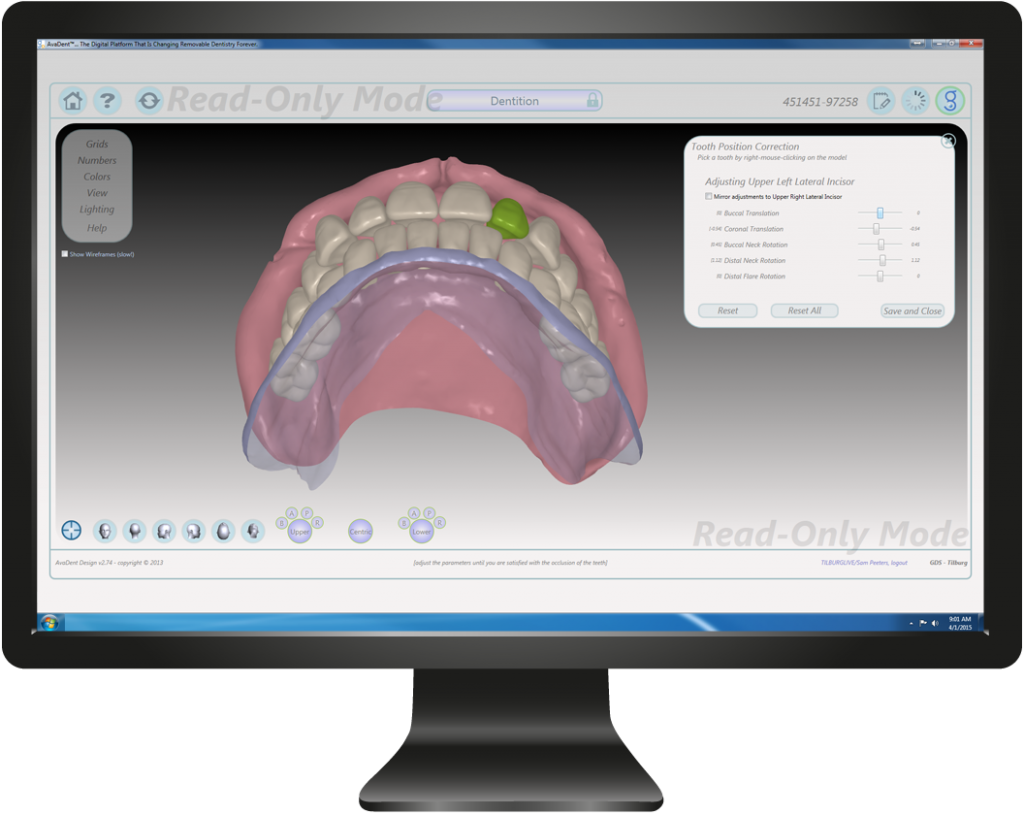 EnvisionTEC and AvaDent Partner to Deliver 3D Printed Denture Solutions ...