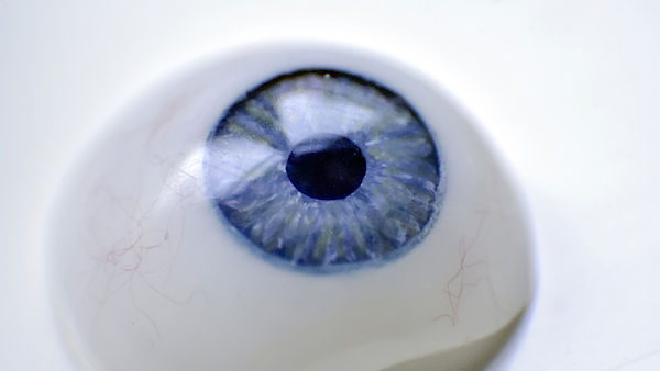 Engineering Student Creates Inexpensive 3D Printed Eye Prosthesis ...