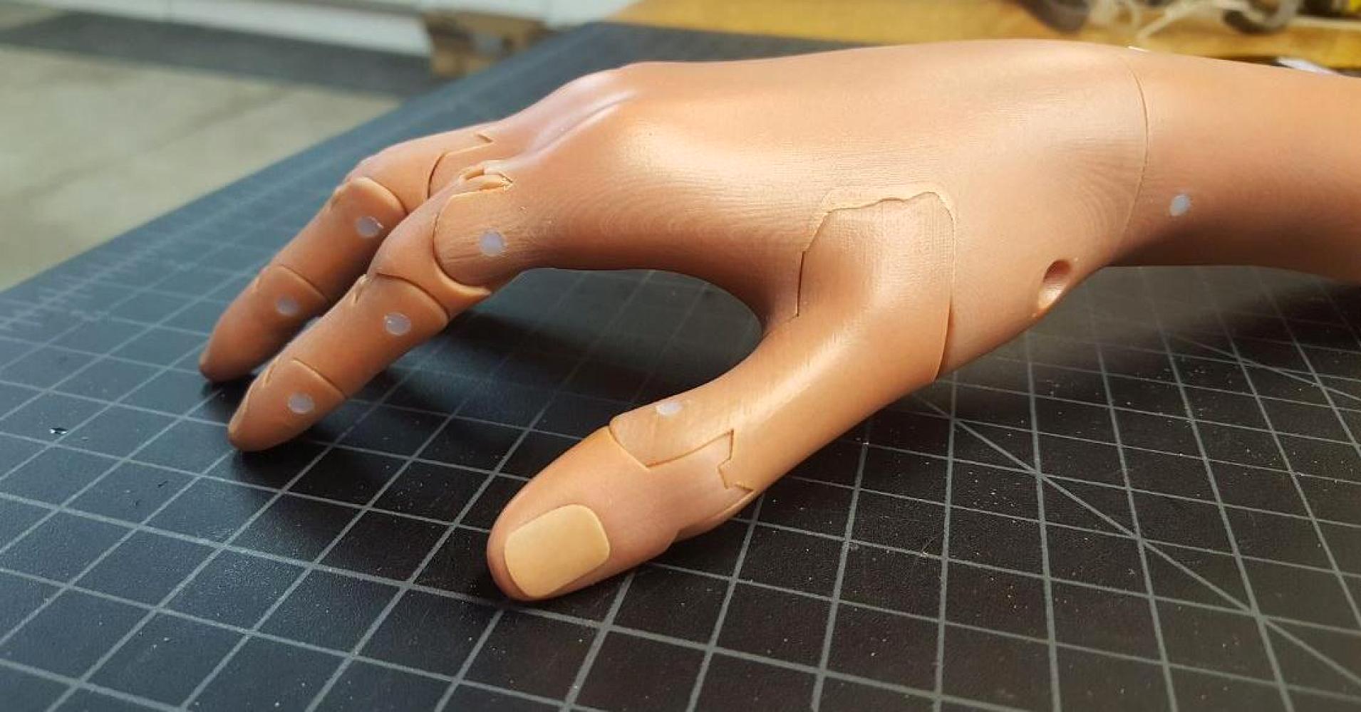 University of Toronto Brings 3D Printed Prosthetic Legs to Children in ...