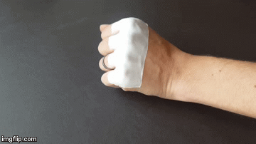 3D Printed Bandages Conform to Skin and Help Heal Wounds - 3DPrint.com ...