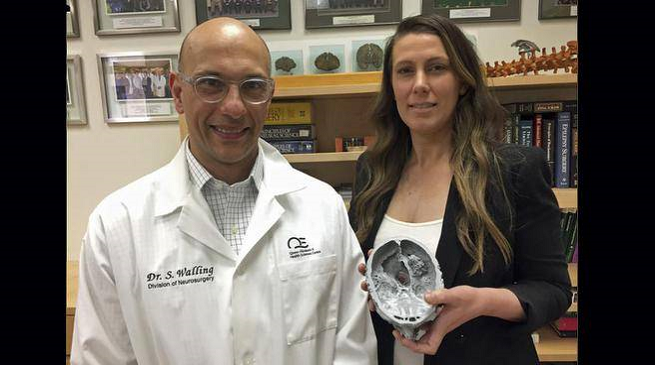Nova Scotia Surgeons Use 3D Printed Brain Model in Surgical Planning ...