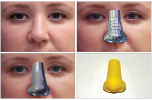 Algorithms and 3D Printing Can Be Used to Create Realistic Nasal ...
