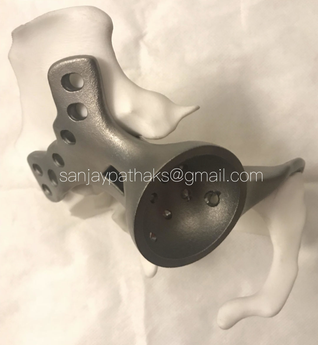 Another First in India: 3D Printed Titanium Implant Helps Man Regain ...