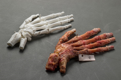 Researchers Compare Human Cadavers and 3D Printed Anatomical Models to ...