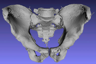 Researchers Compare Human Cadavers and 3D Printed Anatomical Models to ...