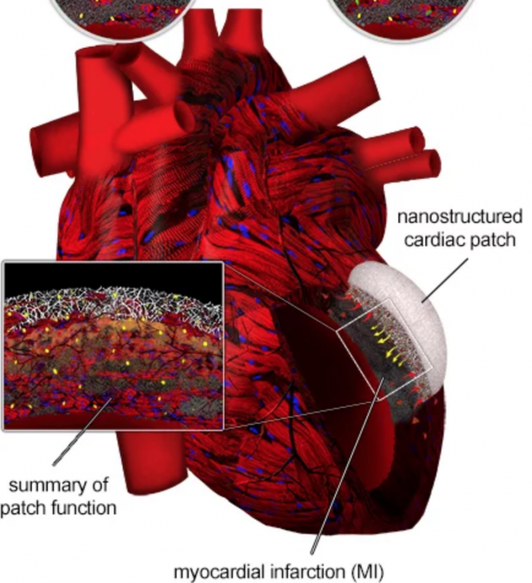 Interview with Dr. Vahid Serpooshan, Who Created a 'Heart Attack Patch ...