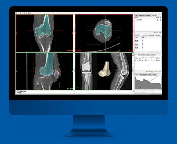 Bioprinting 101 - Part 13, Imaging Technology - 3DPrint.com | Additive ...