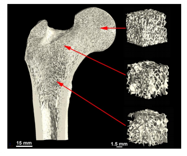 Bone Regeneration: Continued Potential & Success with Titanium in ...