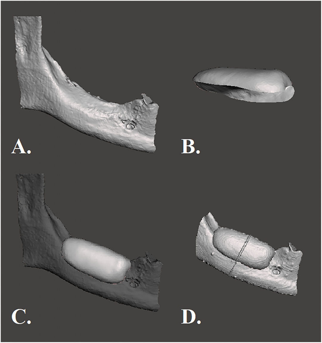 University of Amsterdam: Researchers 3D Printing Grafts for Alveolar ...