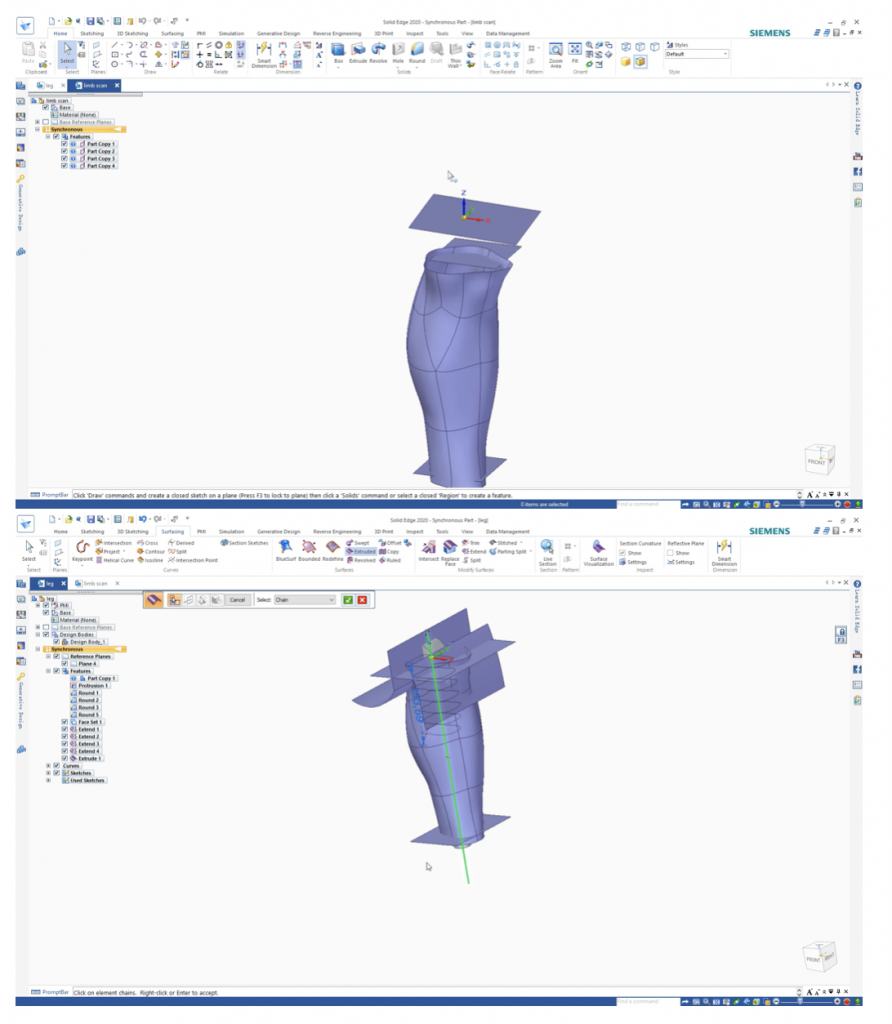 Customized Prosthetics Shell by 3D Scanning and Printing - 3DPrint.com ...