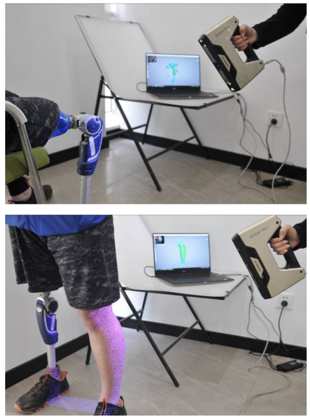 Customized Prosthetics Shell by 3D Scanning and Printing - 3DPrint.com ...