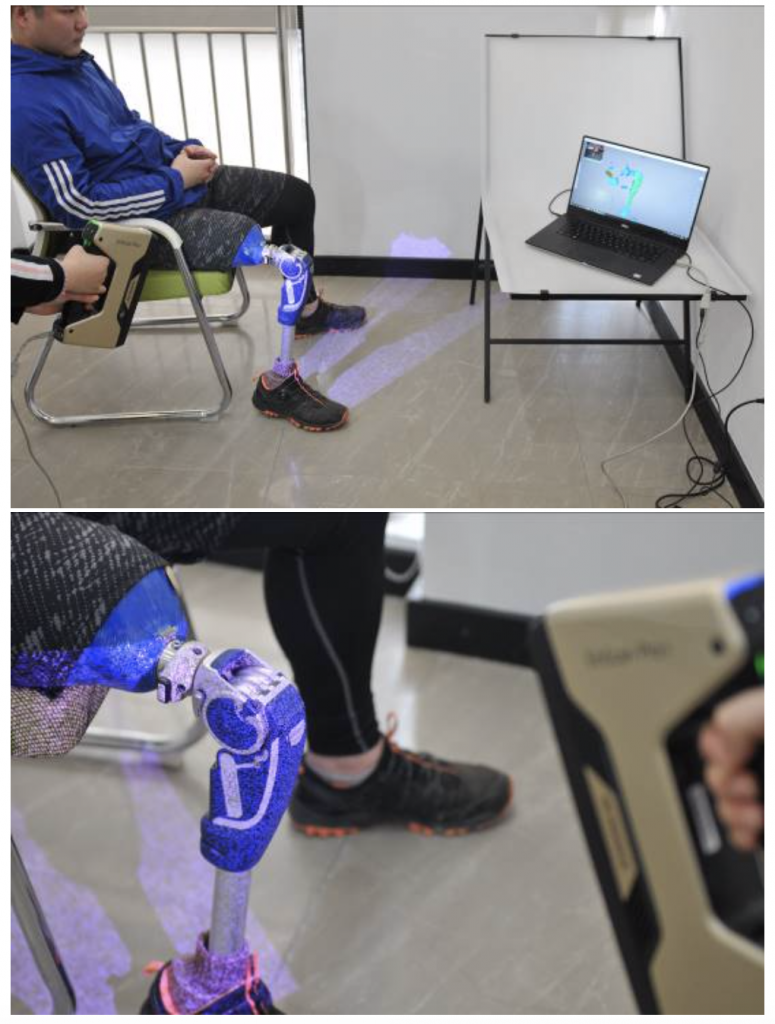 Customized Prosthetics Shell by 3D Scanning and Printing - 3DPrint.com ...