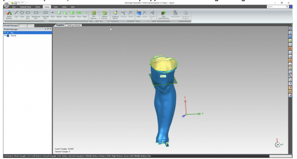 Customized Prosthetics Shell by 3D Scanning and Printing - 3DPrint.com ...
