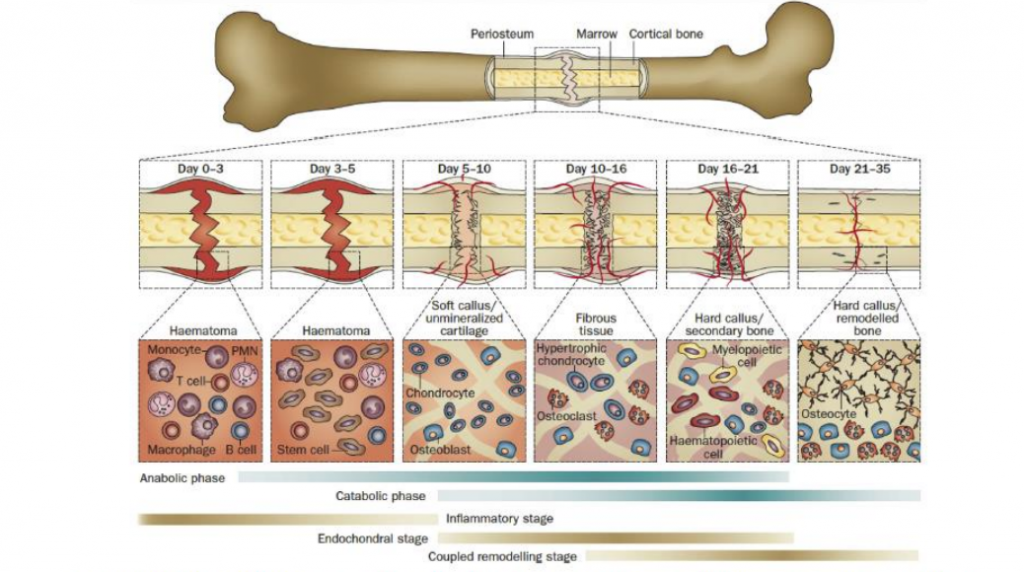 Researchers Testing 3D Printed Hydroxyapatite Structures for Bone ...