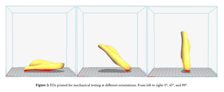 Evaluating the Performance of 3D Printed Foot Orthoses for People with ...