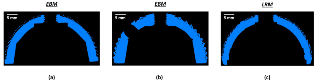 Comparing 3D Printed Titanium Acetabular Cup Implants - 3DPrint.com ...
