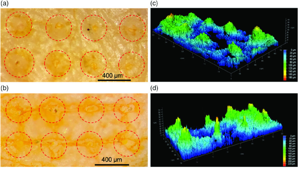 3D Printing Microneedles for Biomedical Applications - 3DPrint.com ...