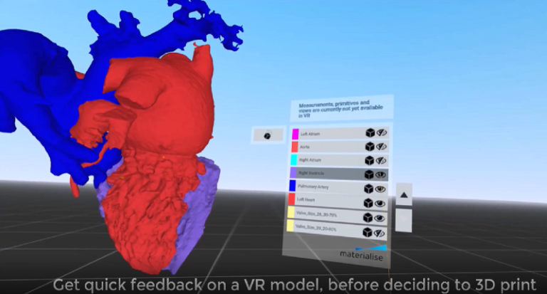 Materialise Integrates VR into Mimics Software for Better 3D Anatomical ...