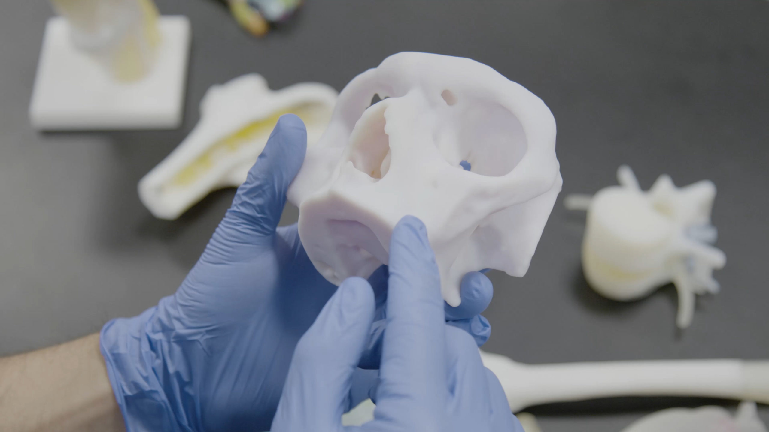 FDA Clears Ricoh Healthcare Solution to 3D Print Personalized ...