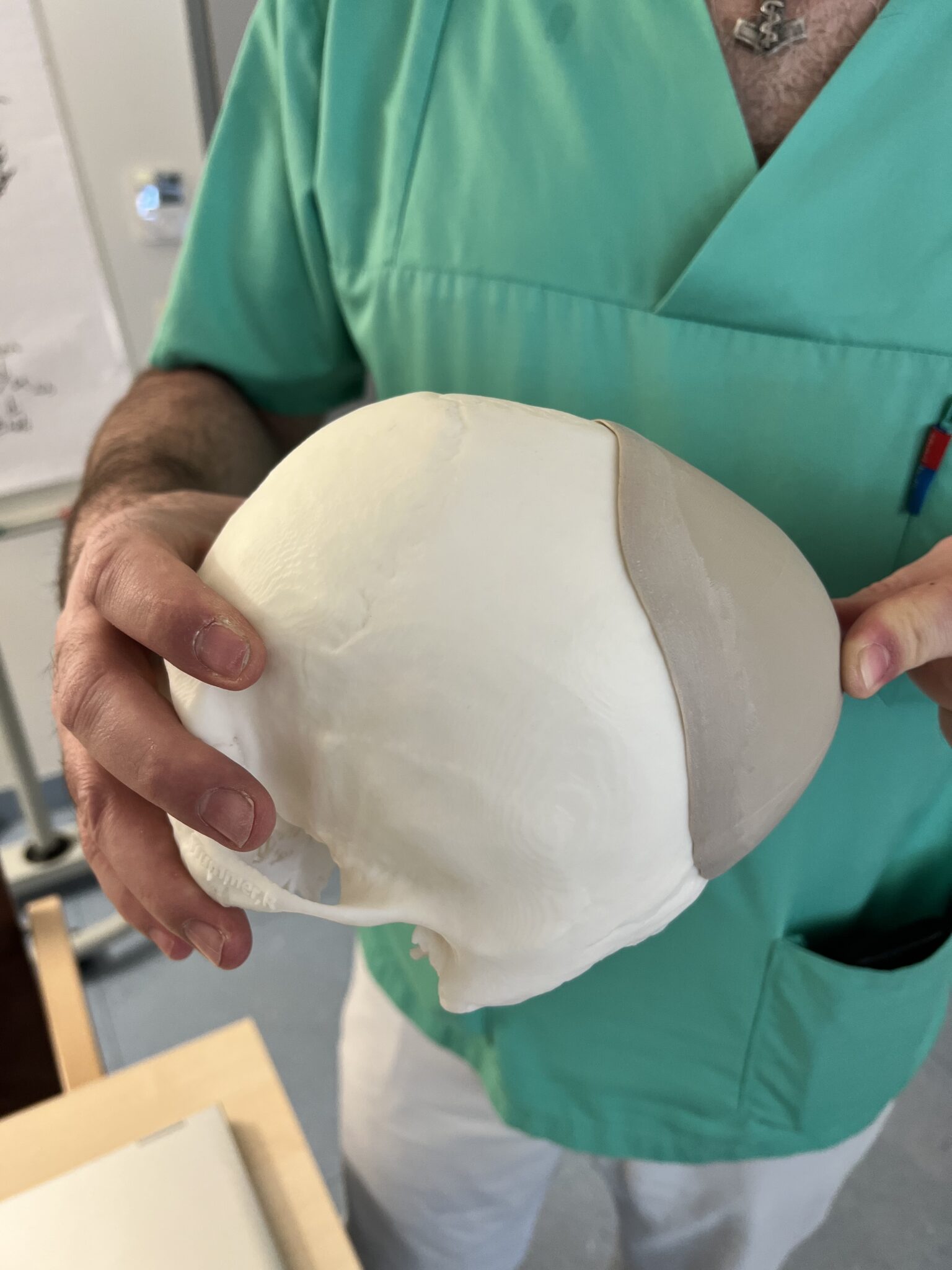Hospital 3D Prints and Implants Skull Device In-House Using Kumovis ...