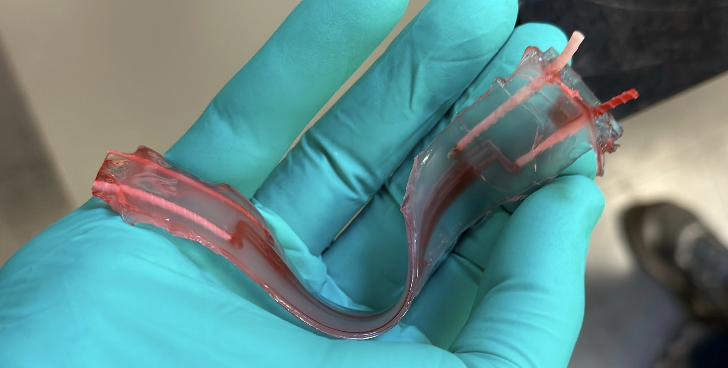 Surgeon Led Startup Wins KidneyX Prize For Bioartificial Kidney Surgeon Led Startup Wins KidneyX Prize For Bioartificial Kidney