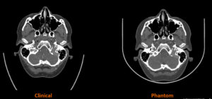 Siemens and Stratasys to Boost CT Scanning Efficacy with 3D Printing ...