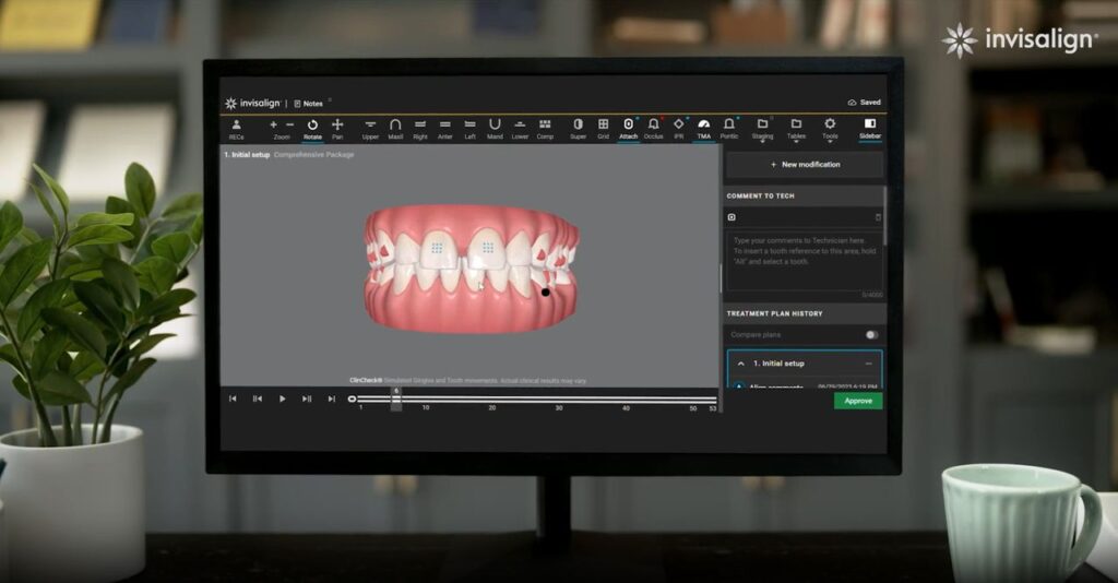 3D Printing Financials: Align Technology Hits Record Q4 2025 on Aligner ...