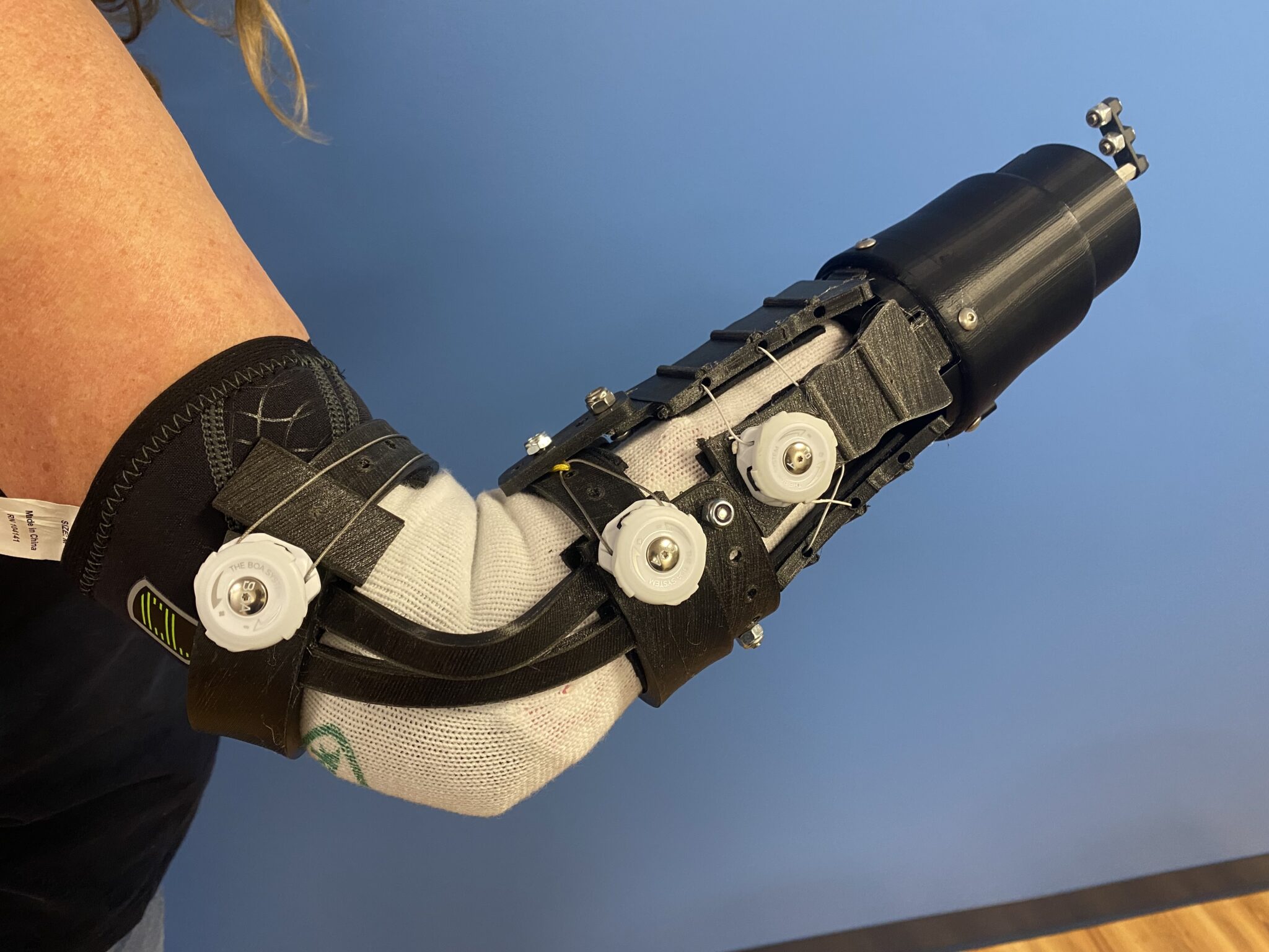 Tinkering for Change: 12th Grader’s Universal Fit 3D Printed Prosthetic ...
