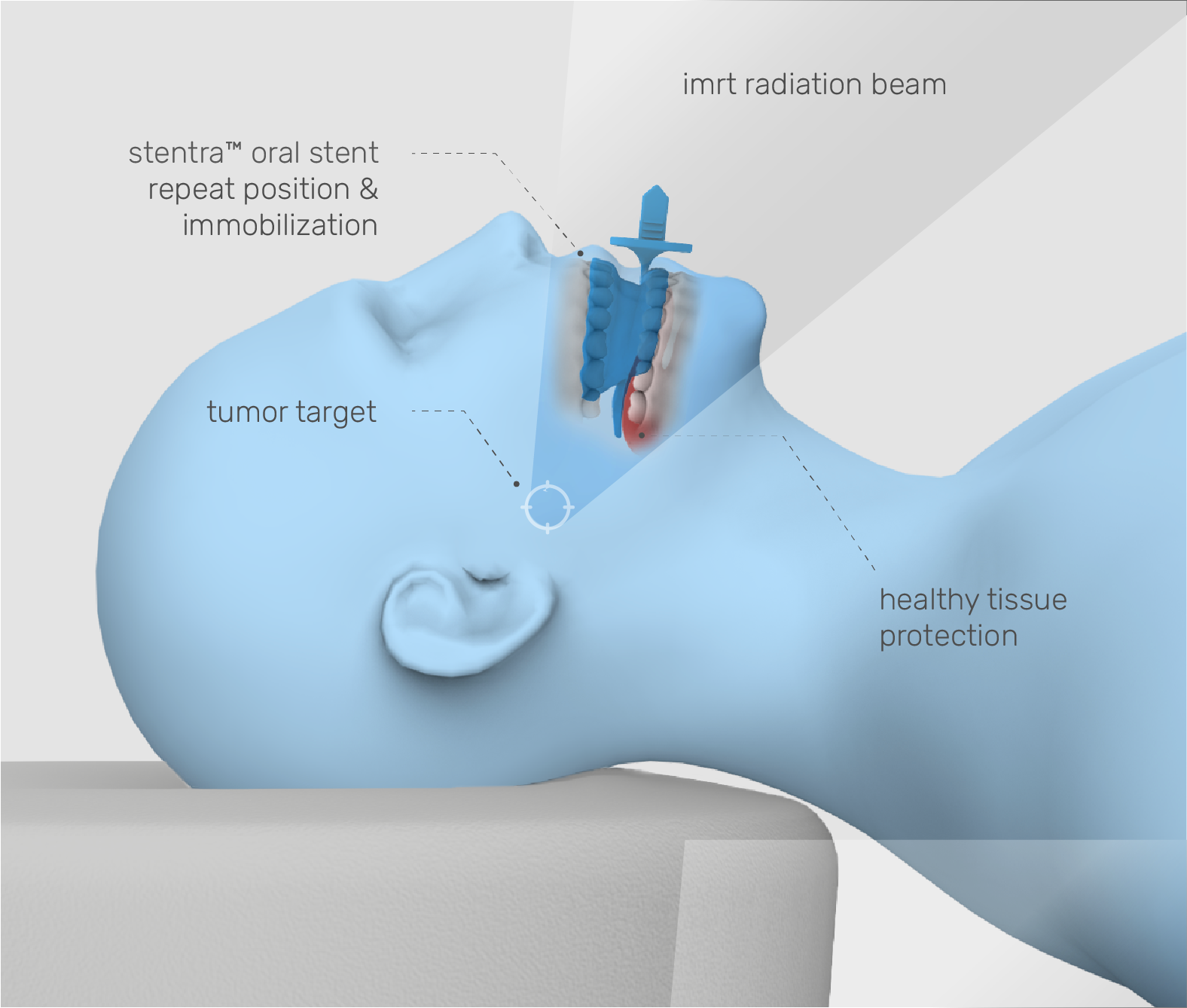 Advanced 3D Printed Medtech Solutions Transform Healthcare Treatments ...