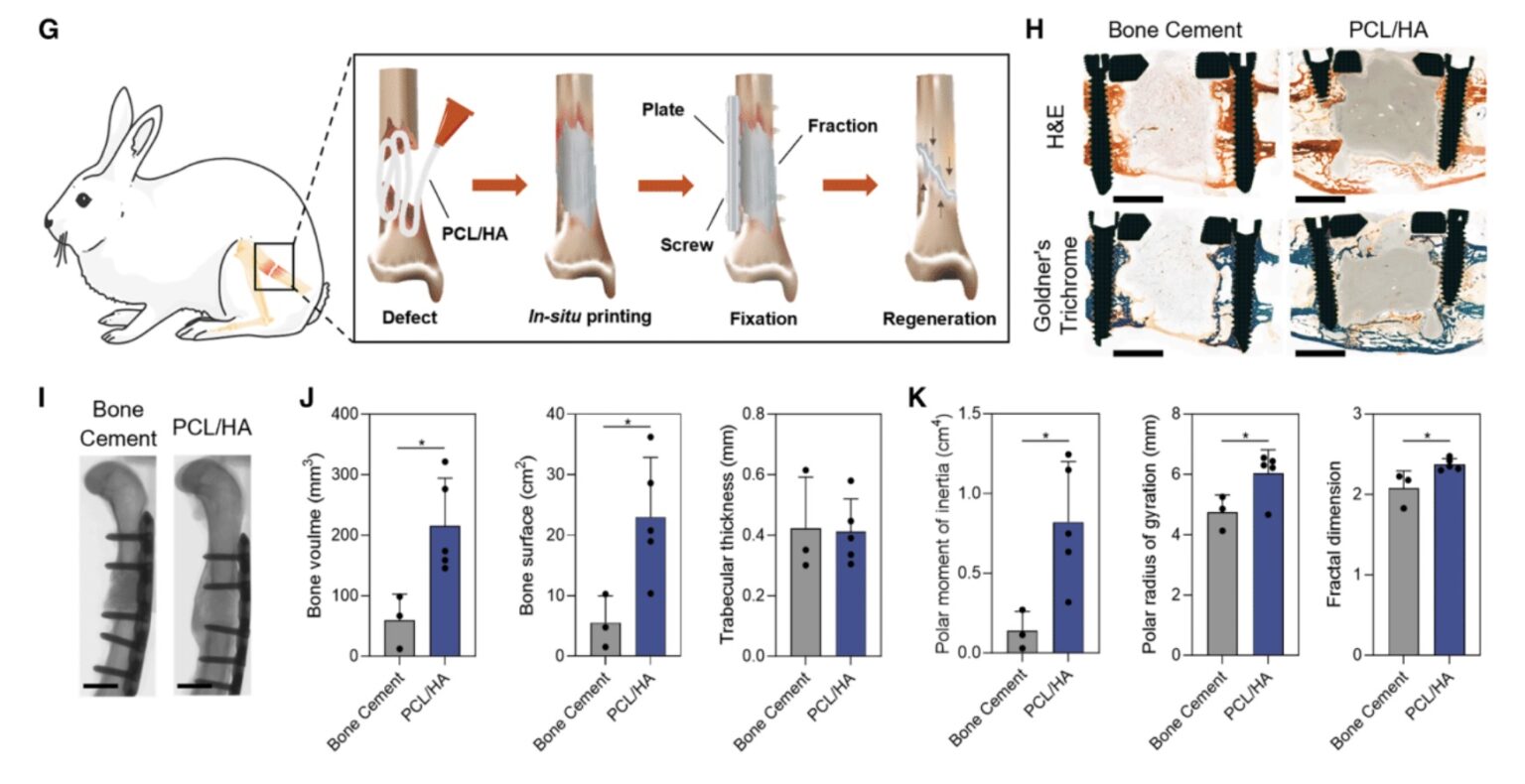 Handheld 3D Printer Repairs Bone Like a Glue Gun — Tested in Rabbits ...