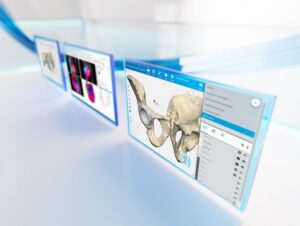 3D Printing Financials: Materialise Reports Strong Finish to 2025, Led ...